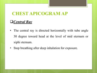 CHEST RADIOGRAPHY - Routine & special radiographs | PPTX
