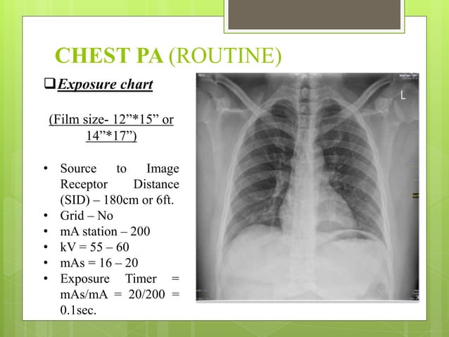 CHEST RADIOGRAPHY - Routine & special radiographs | PPTX