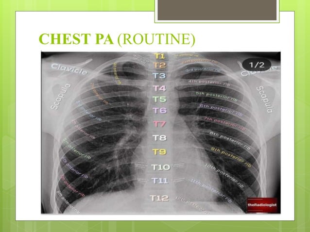 CHEST RADIOGRAPHY - Routine & special radiographs | PPTX