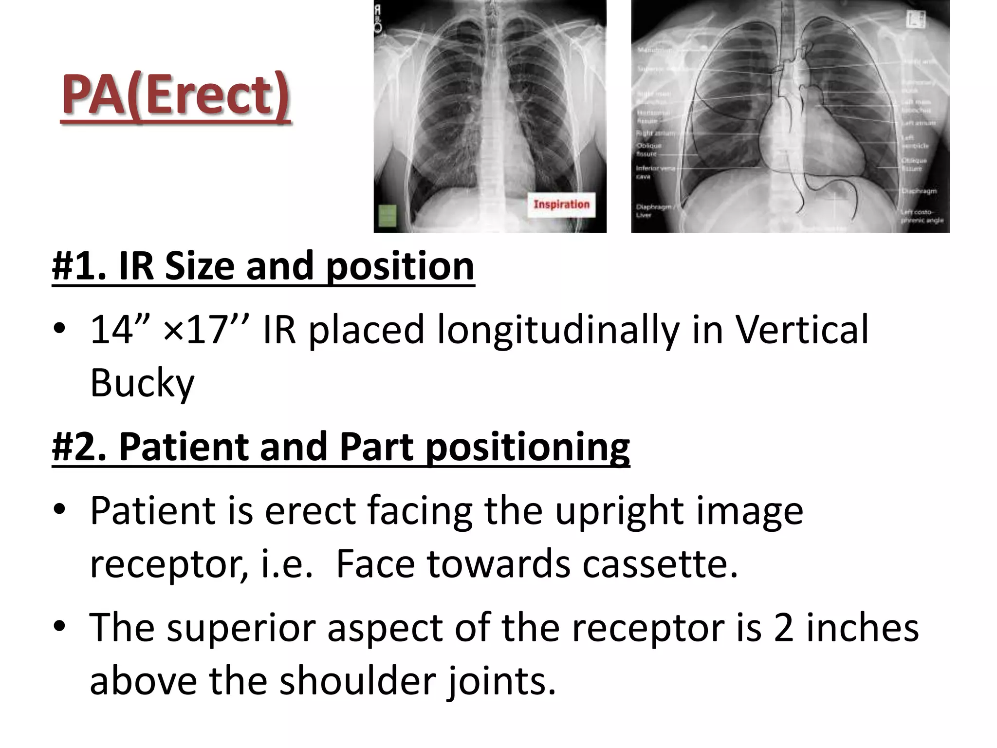 Chest radiography ppt | PPTX