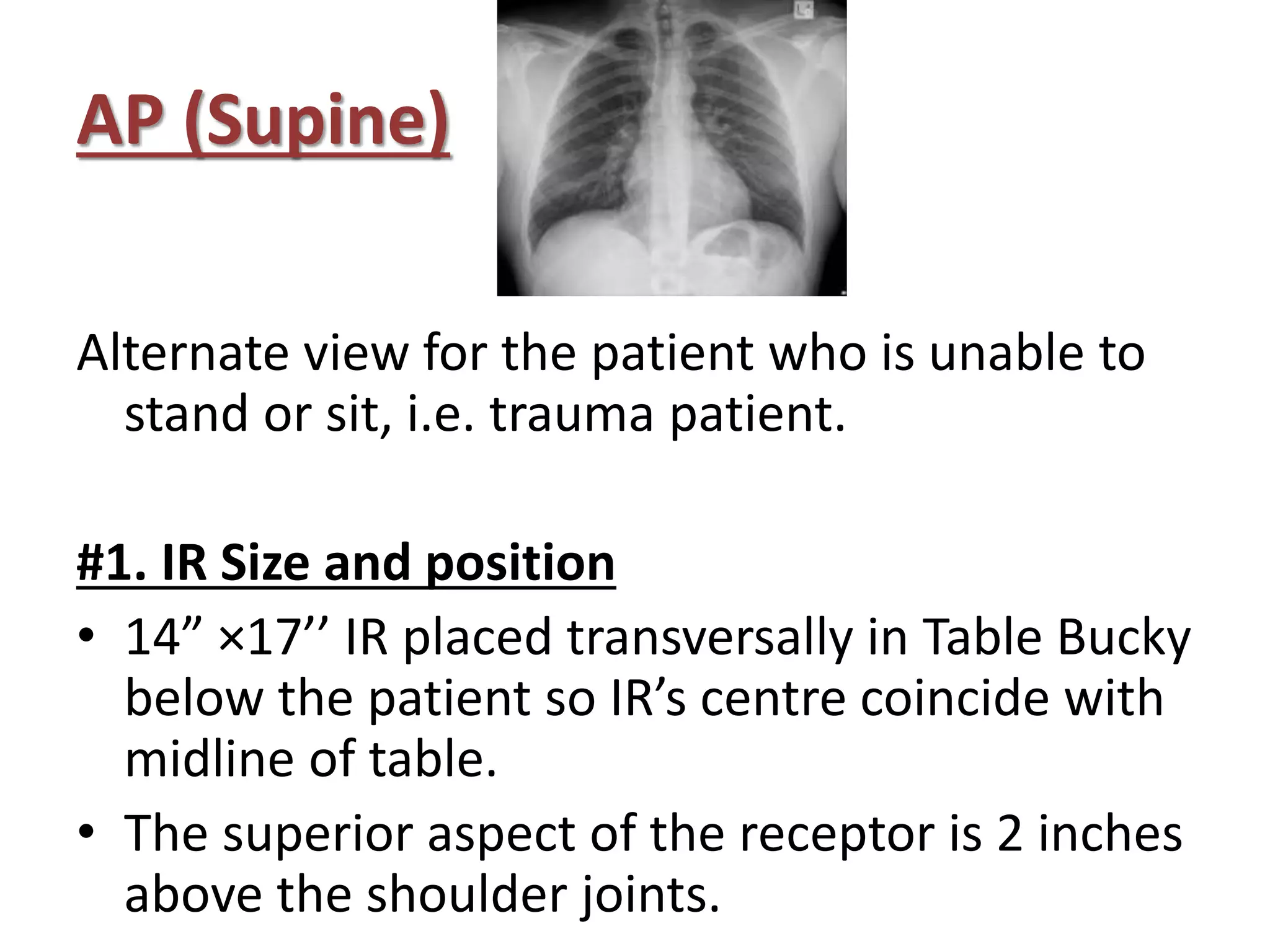 Chest radiography ppt | PPTX