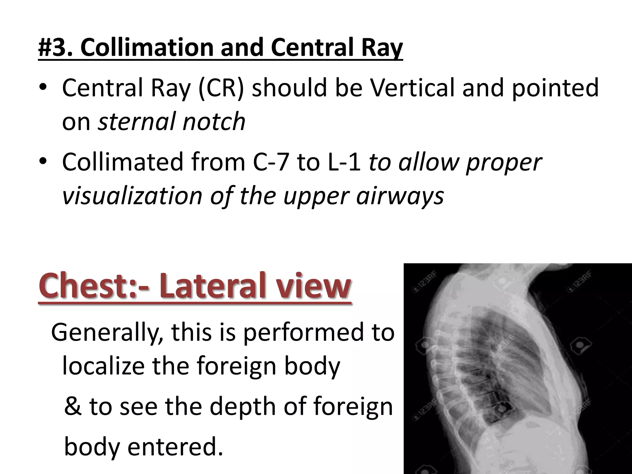 Chest radiography ppt | PPTX