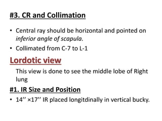 Chest radiography ppt | PPTX
