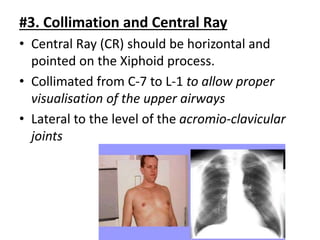 Chest radiography ppt | PPTX