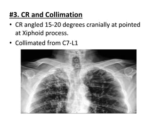 Chest radiography ppt | PPTX