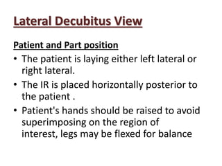 Chest radiography ppt | PPTX