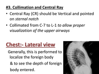 Chest radiography ppt | PPTX