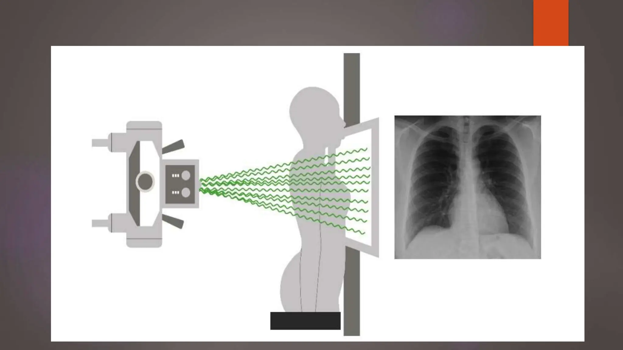 chest radiography done in radiology .pptx