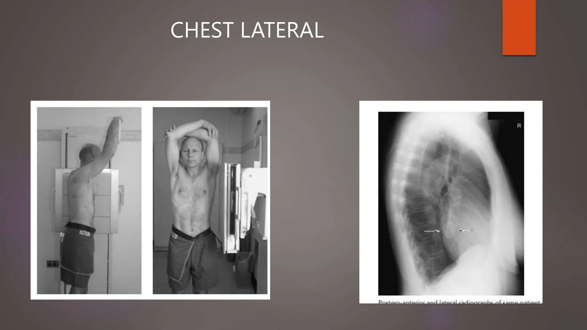chest radiography done in radiology .pptx