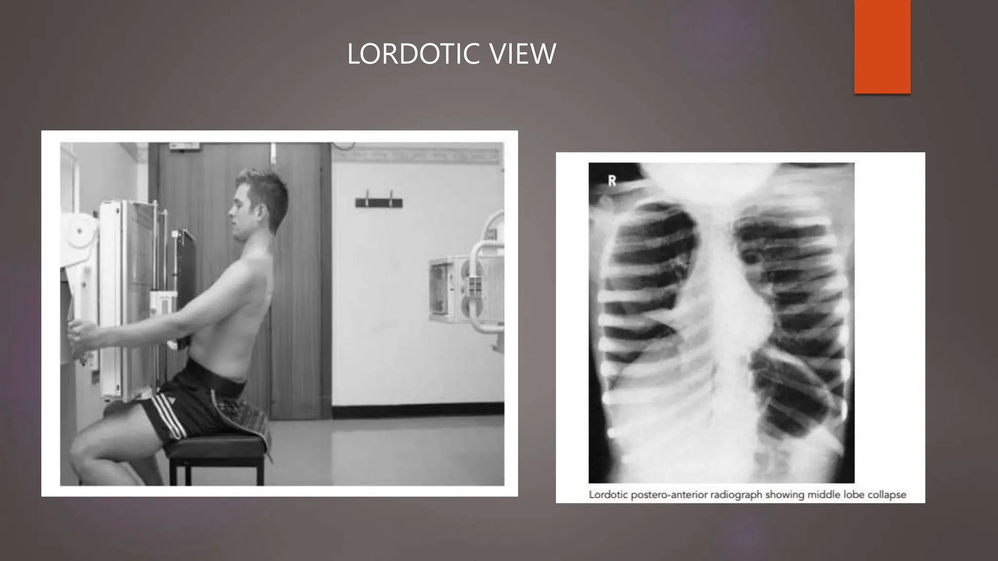 chest radiography done in radiology .pptx