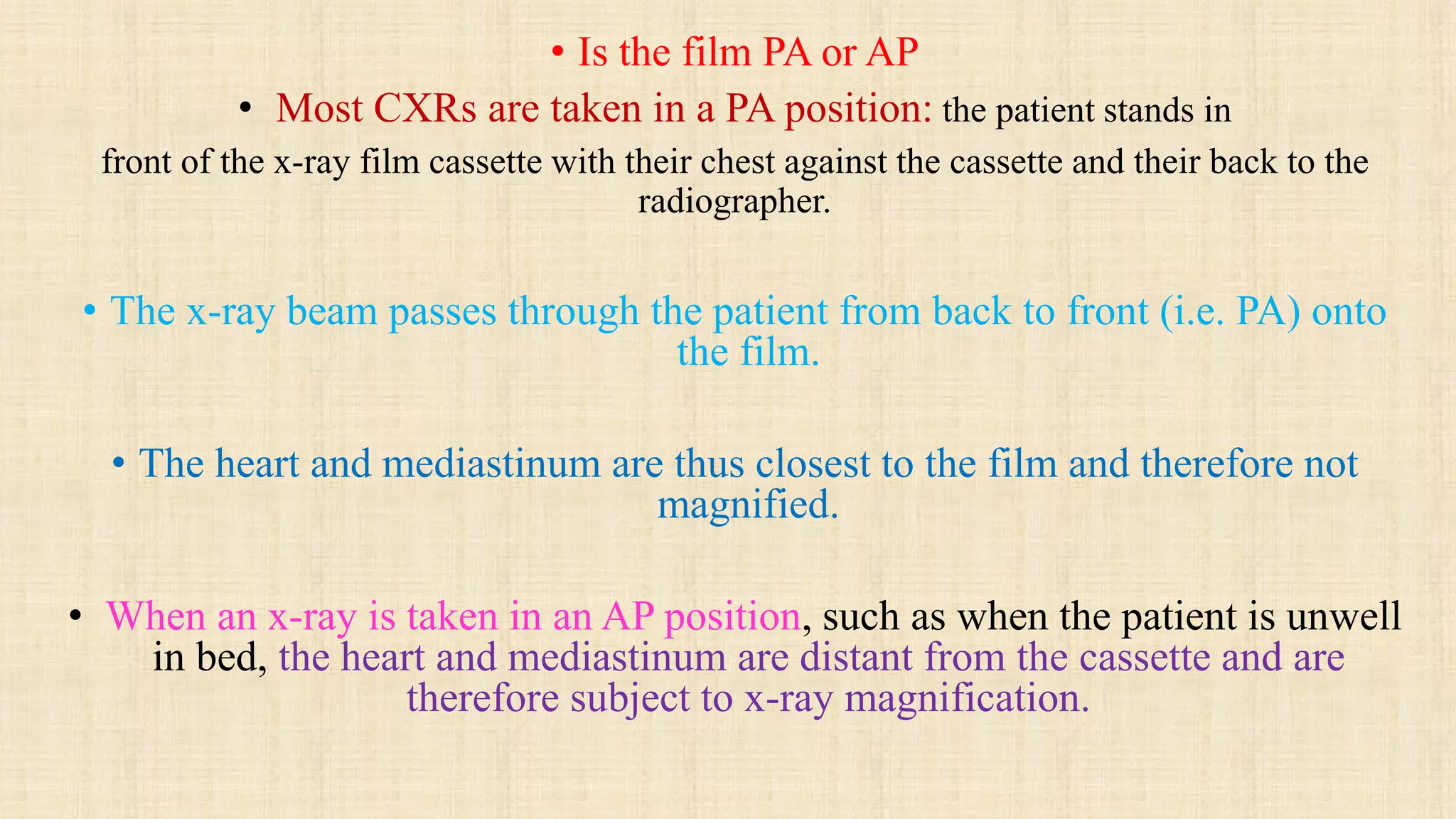 Chest radiology | PPT