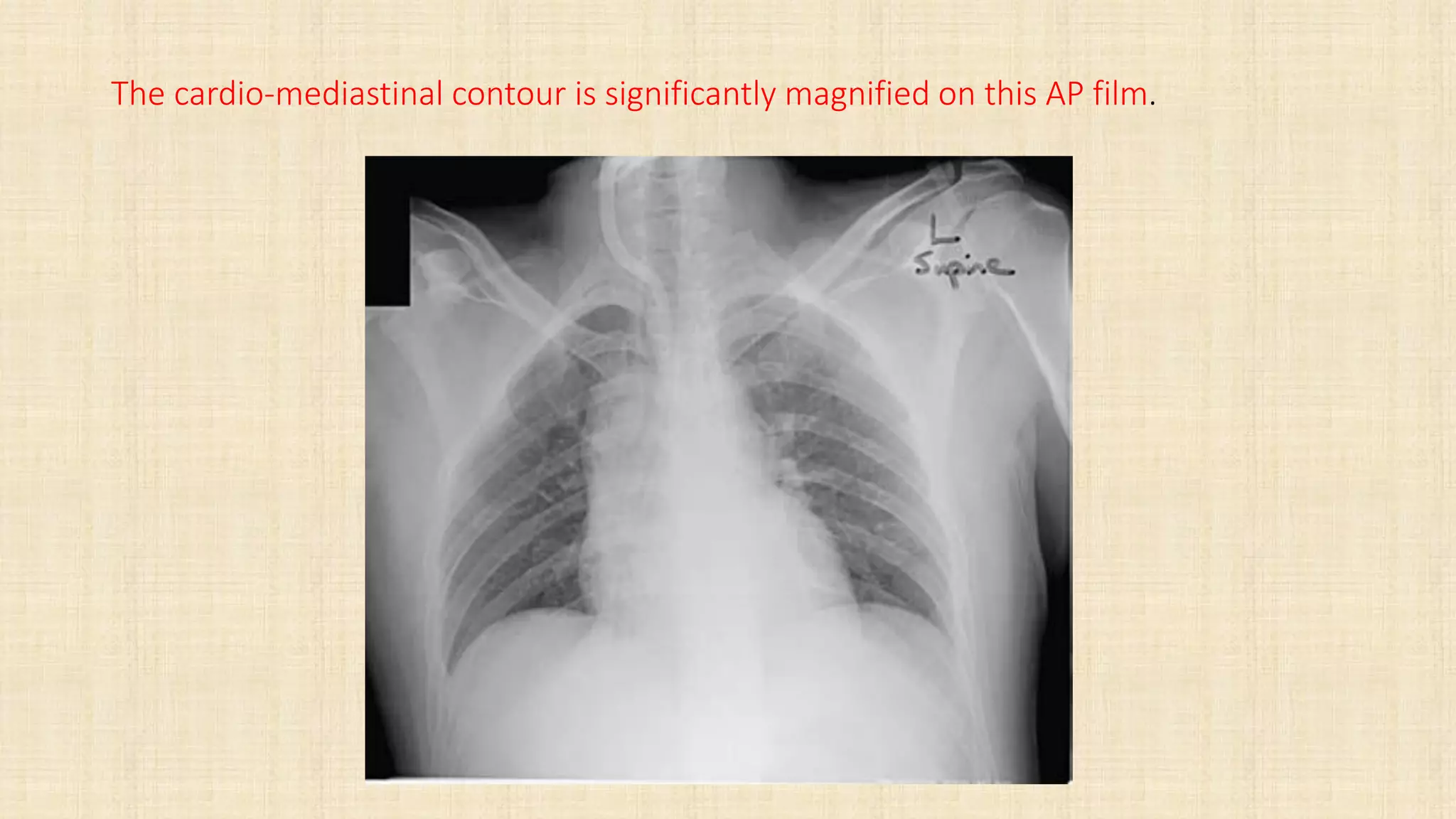 Chest radiology | PPT