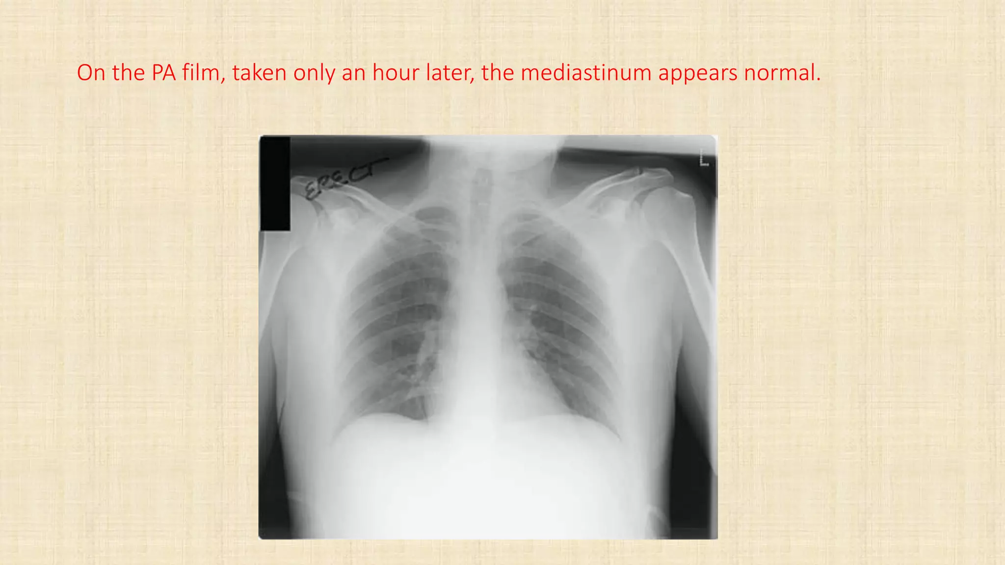 Chest radiology | PPT