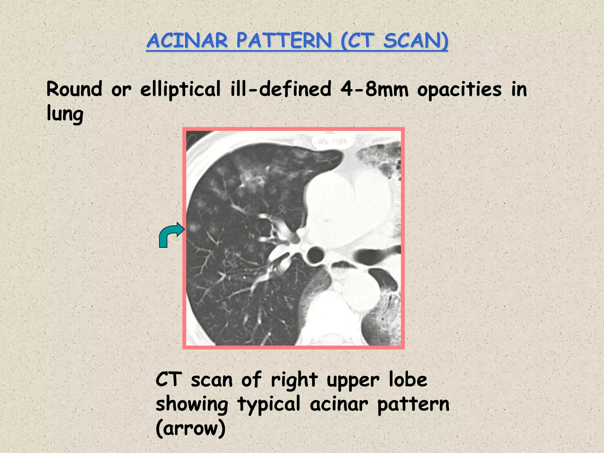 Chest Radiology.ppt
