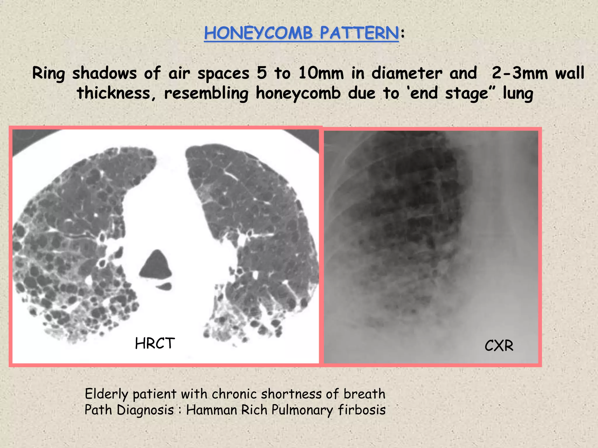 Chest Radiology.ppt