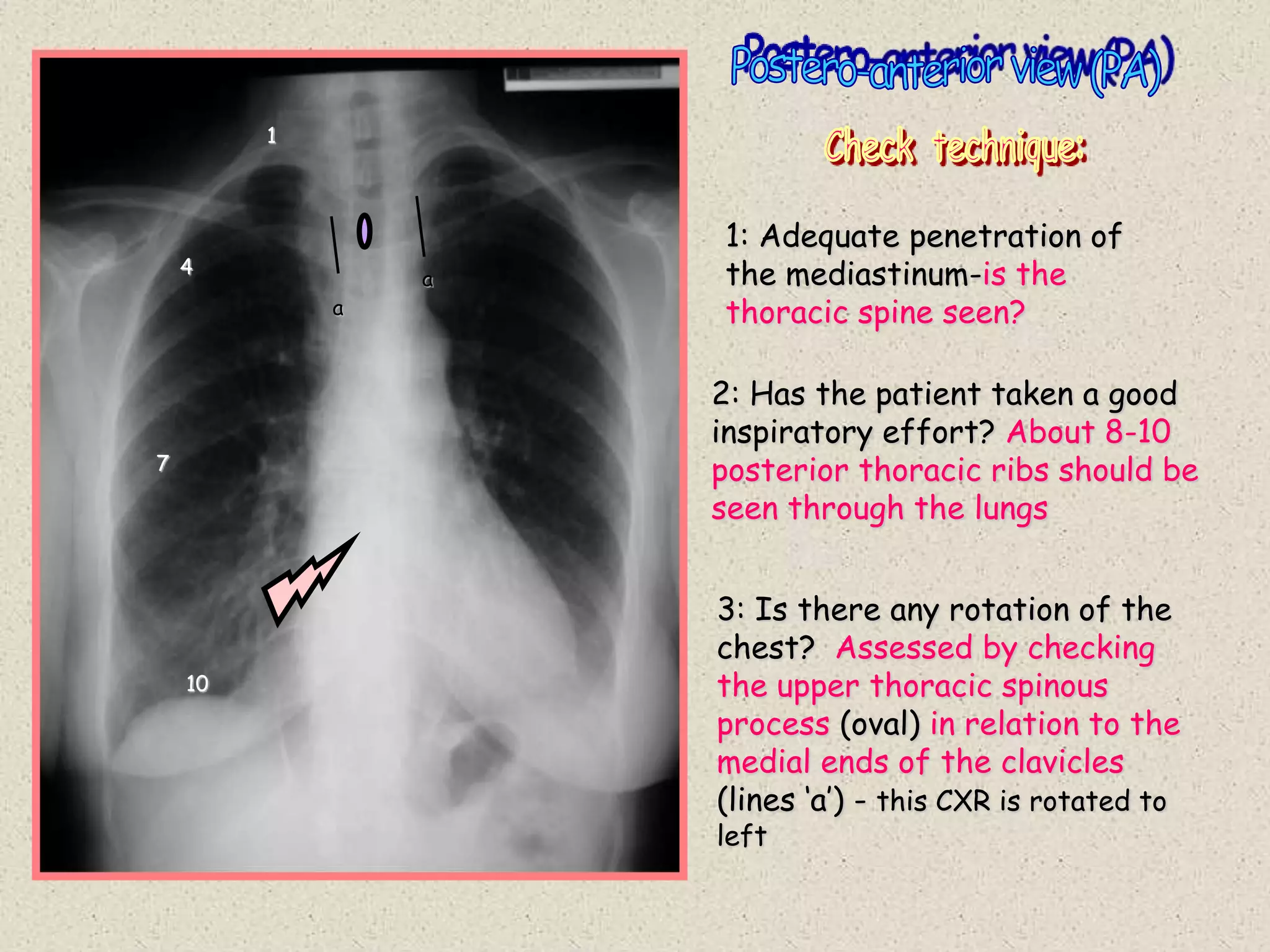Chest Radiology.ppt