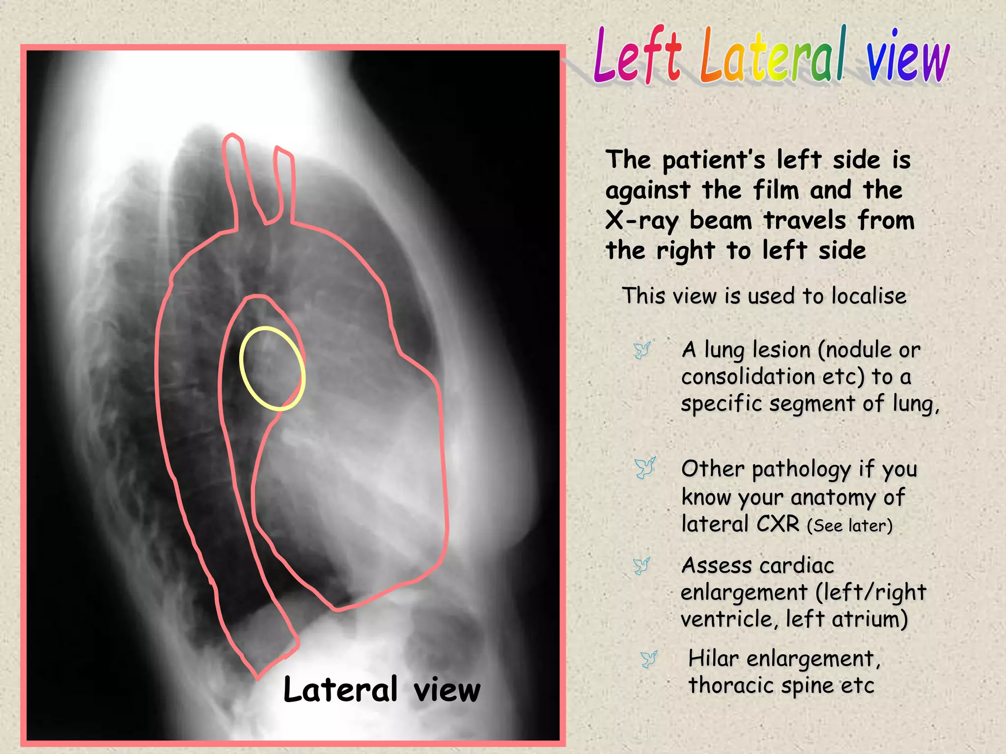 Chest Radiology.ppt | Lung and Respiratory Health | Diseases and Conditions