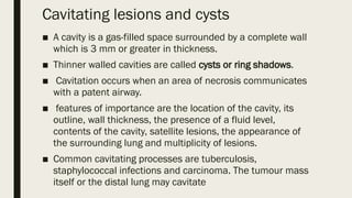 CHEST RADIOLOGY (Respiratory System).pptx