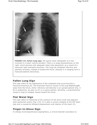 Chest radiology essentials signs | PDF