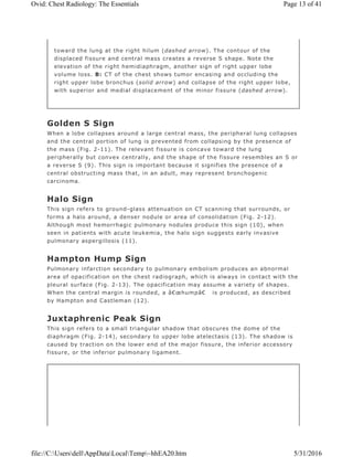 Chest radiology essentials signs | PDF