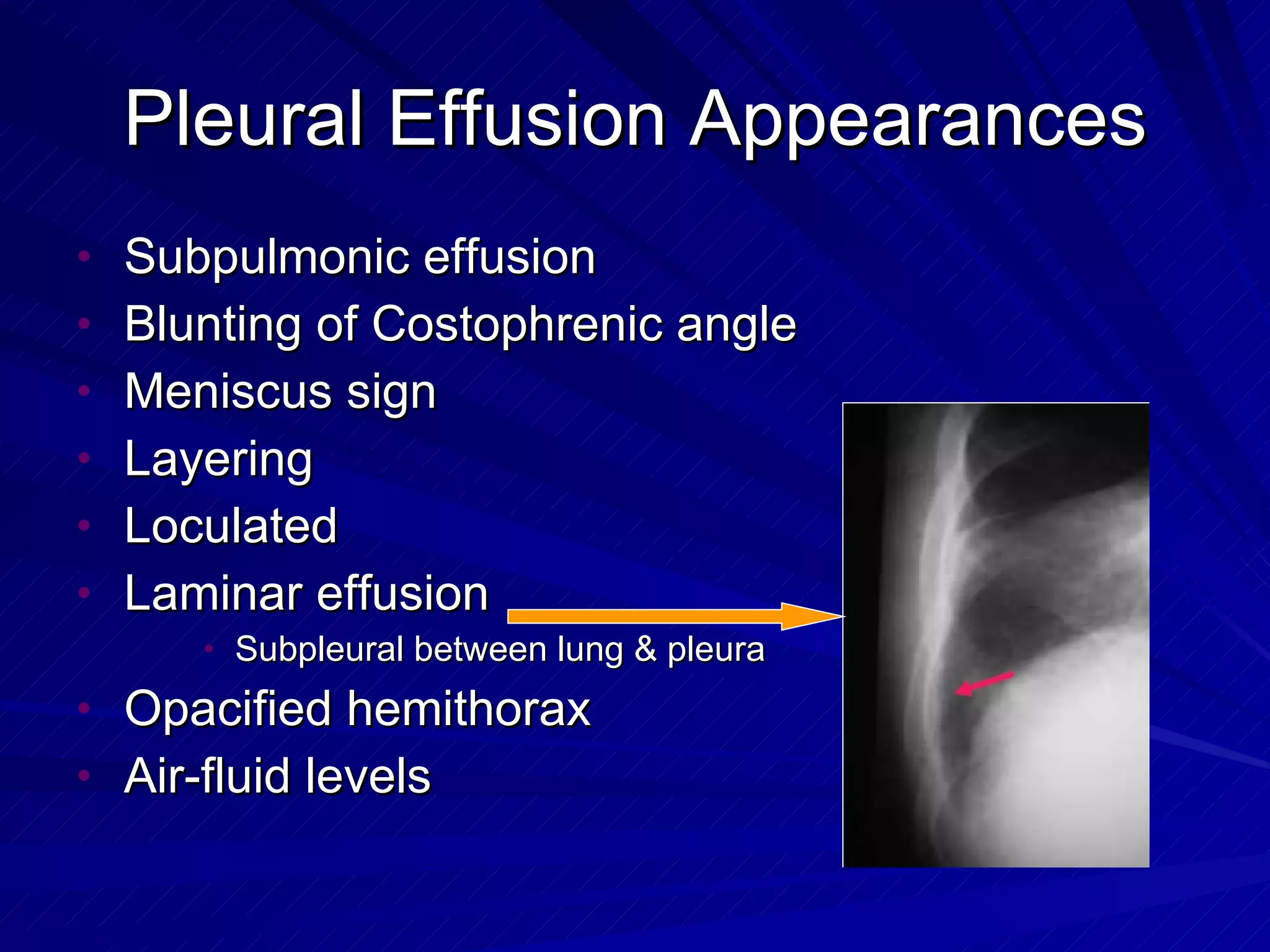 Chest radiology in intensive care | PPT