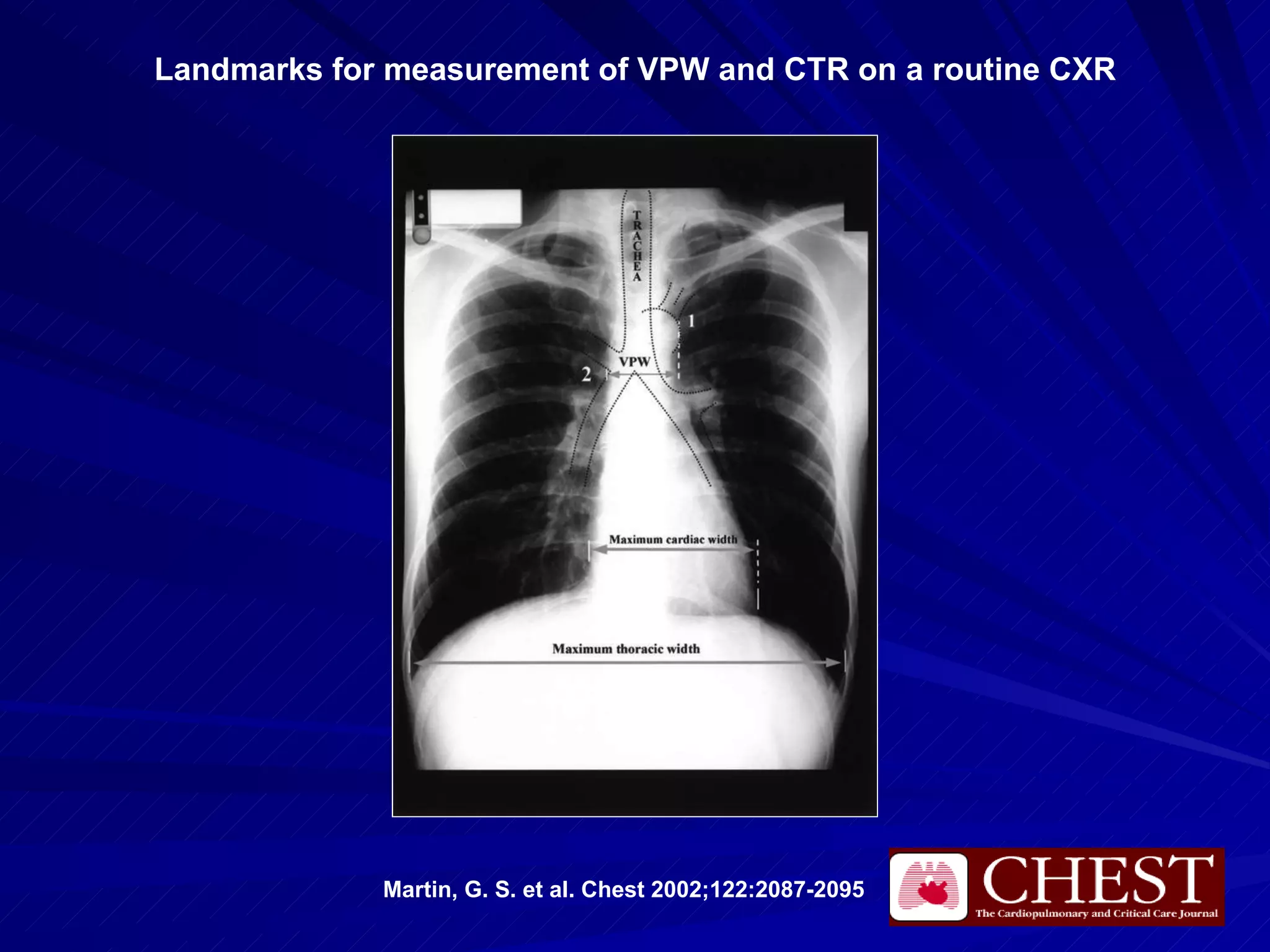 Chest radiology in intensive care | PPT