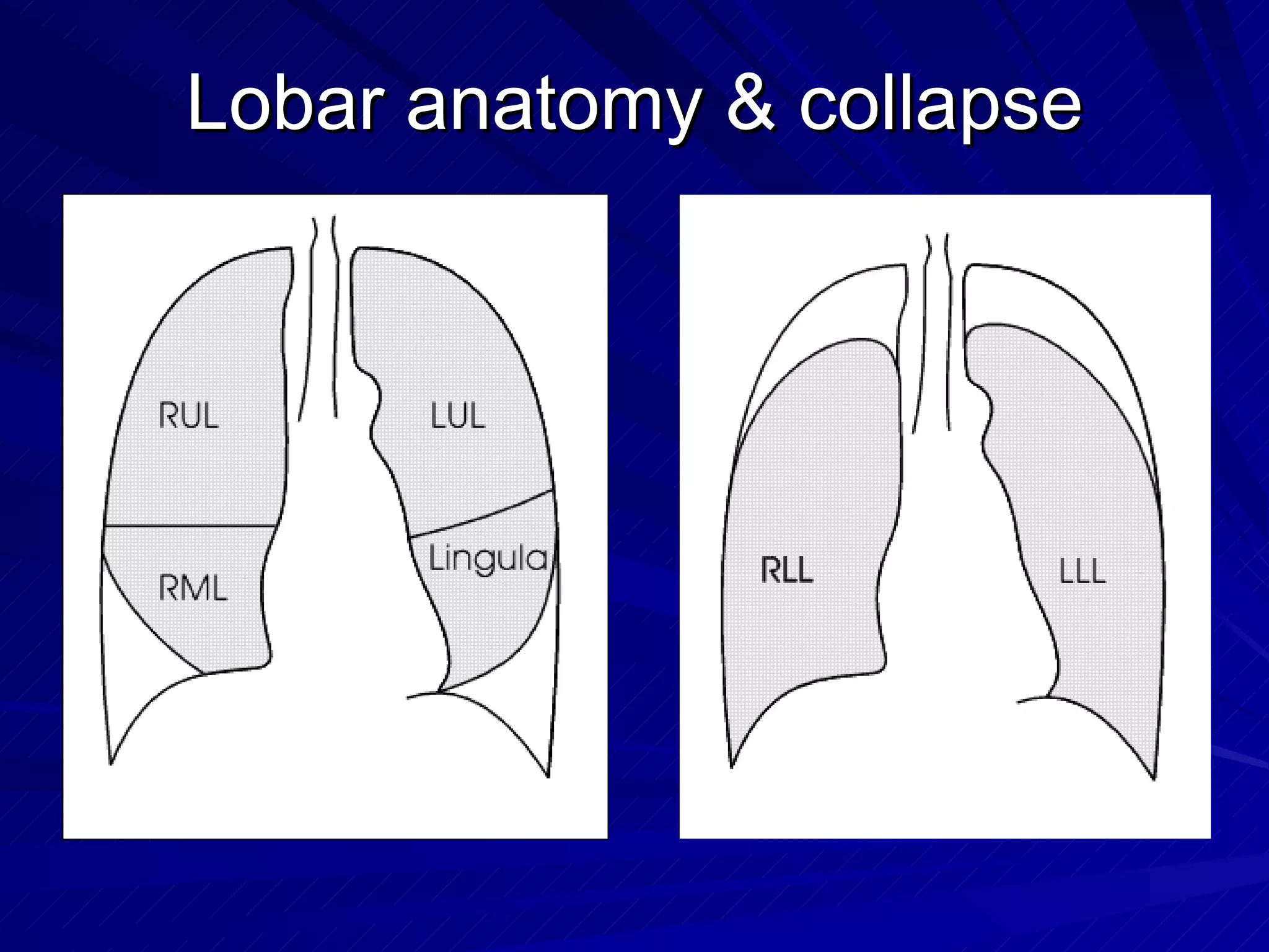 Chest radiology in intensive care | PPT