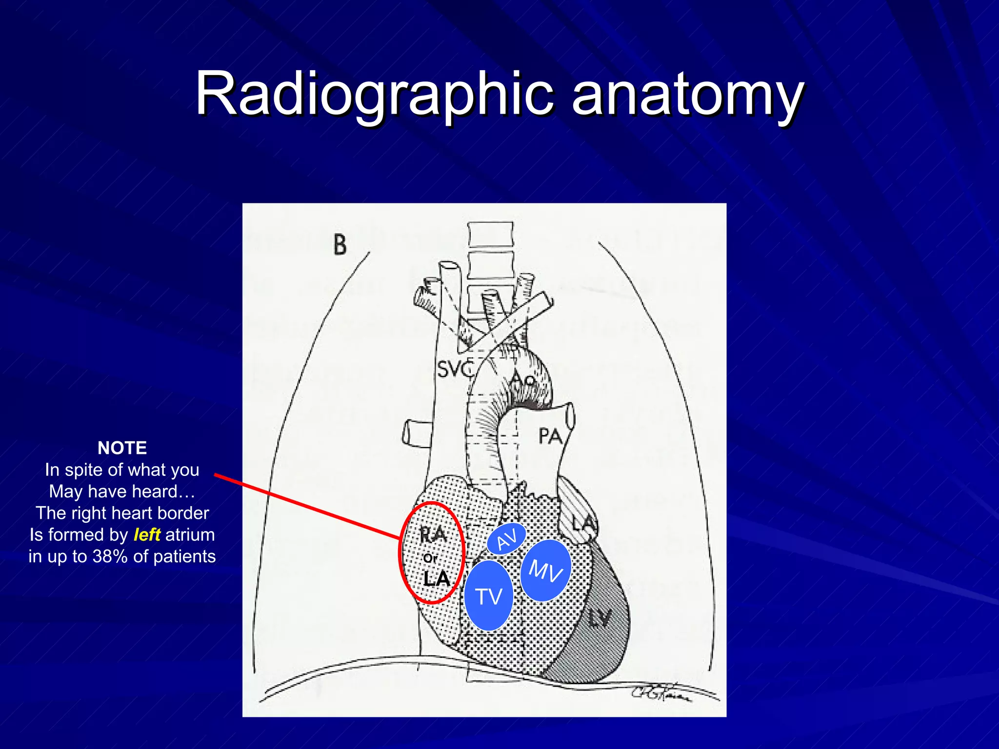 Chest radiology in intensive care | PPT