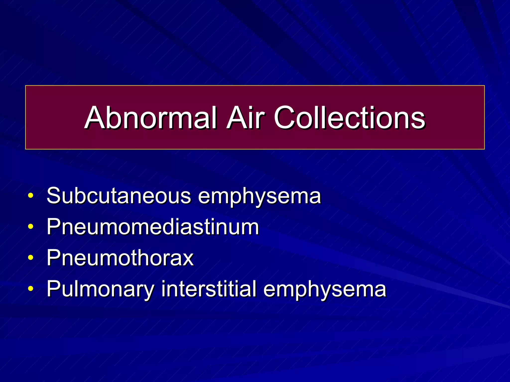 Chest radiology in intensive care | PPT