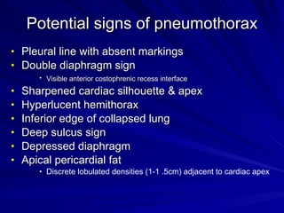 Chest radiology in intensive care | PPT