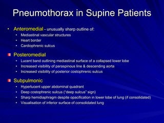 Chest radiology in intensive care | PPT
