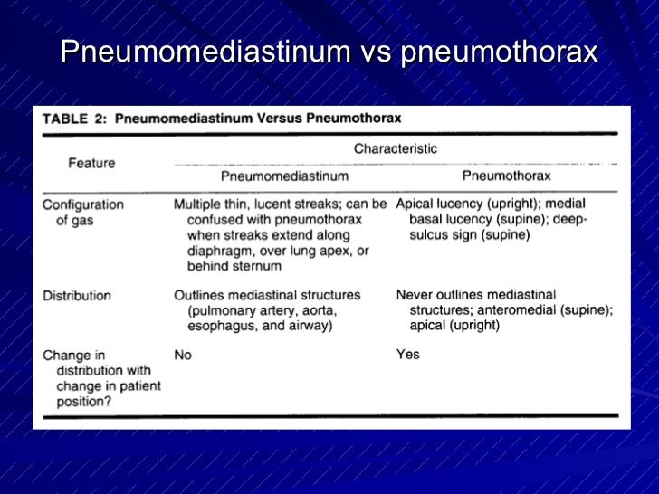 Chest radiology in intensive care