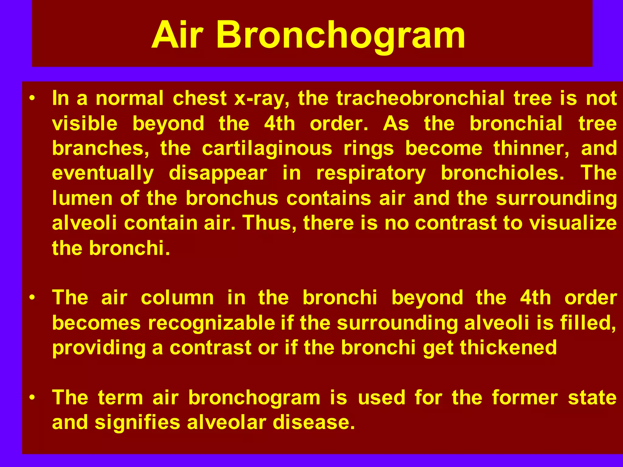 Chest radiology part 1 | PDF