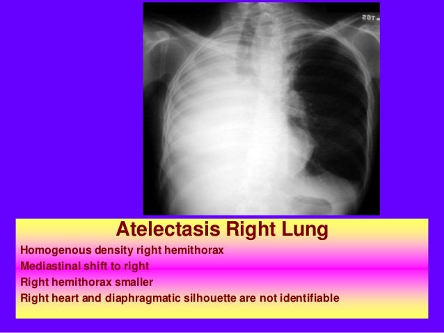 Chest radiology part 1