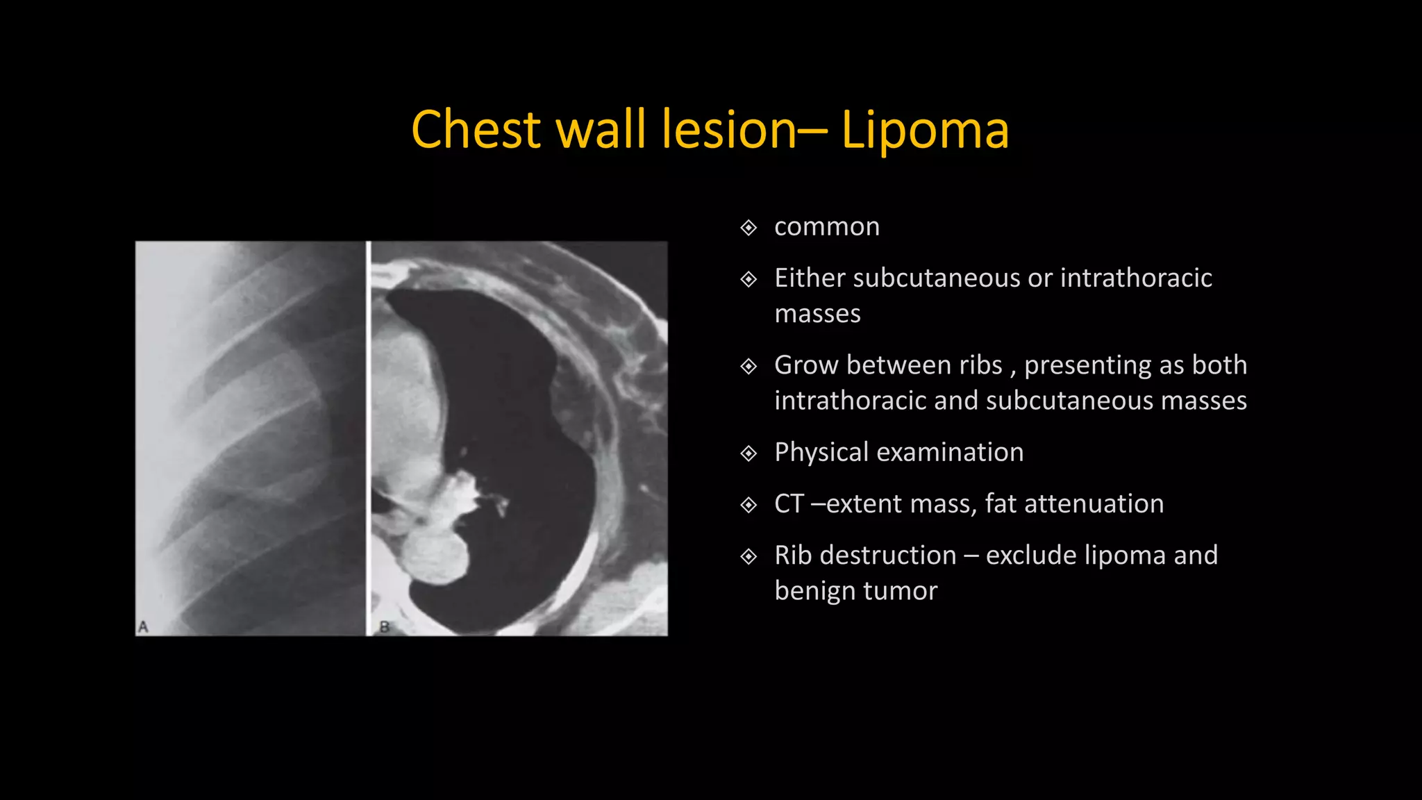 Chest radiology pattern and differential diagnosis ( chest wall and ...