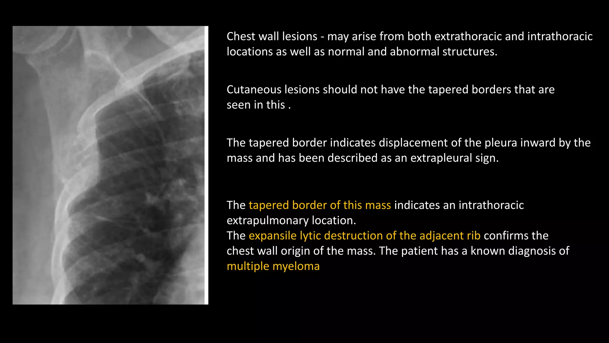 Chest radiology pattern and differential diagnosis ( chest wall and ...