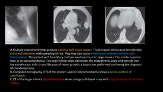 Chest radiology pattern and differential diagnosis ( chest wall and ...