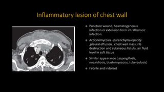 Chest radiology pattern and differential diagnosis ( chest wall and ...