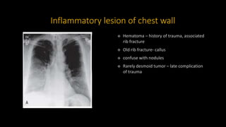 Chest radiology pattern and differential diagnosis ( chest wall and ...