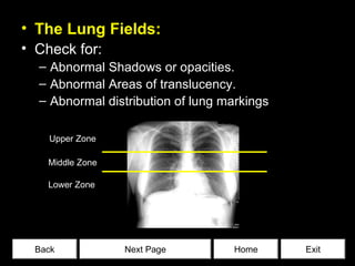 Chest radiology quiz | PPS