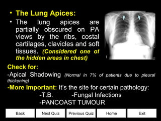 Chest radiology quiz | PPS