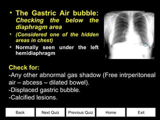 Chest radiology quiz | PPS