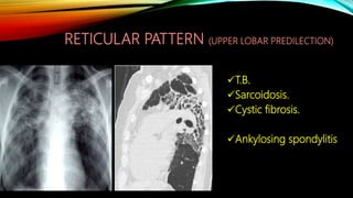 Chest signs | PPTX