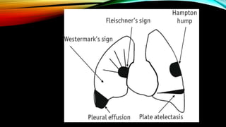 Chest signs | PPT