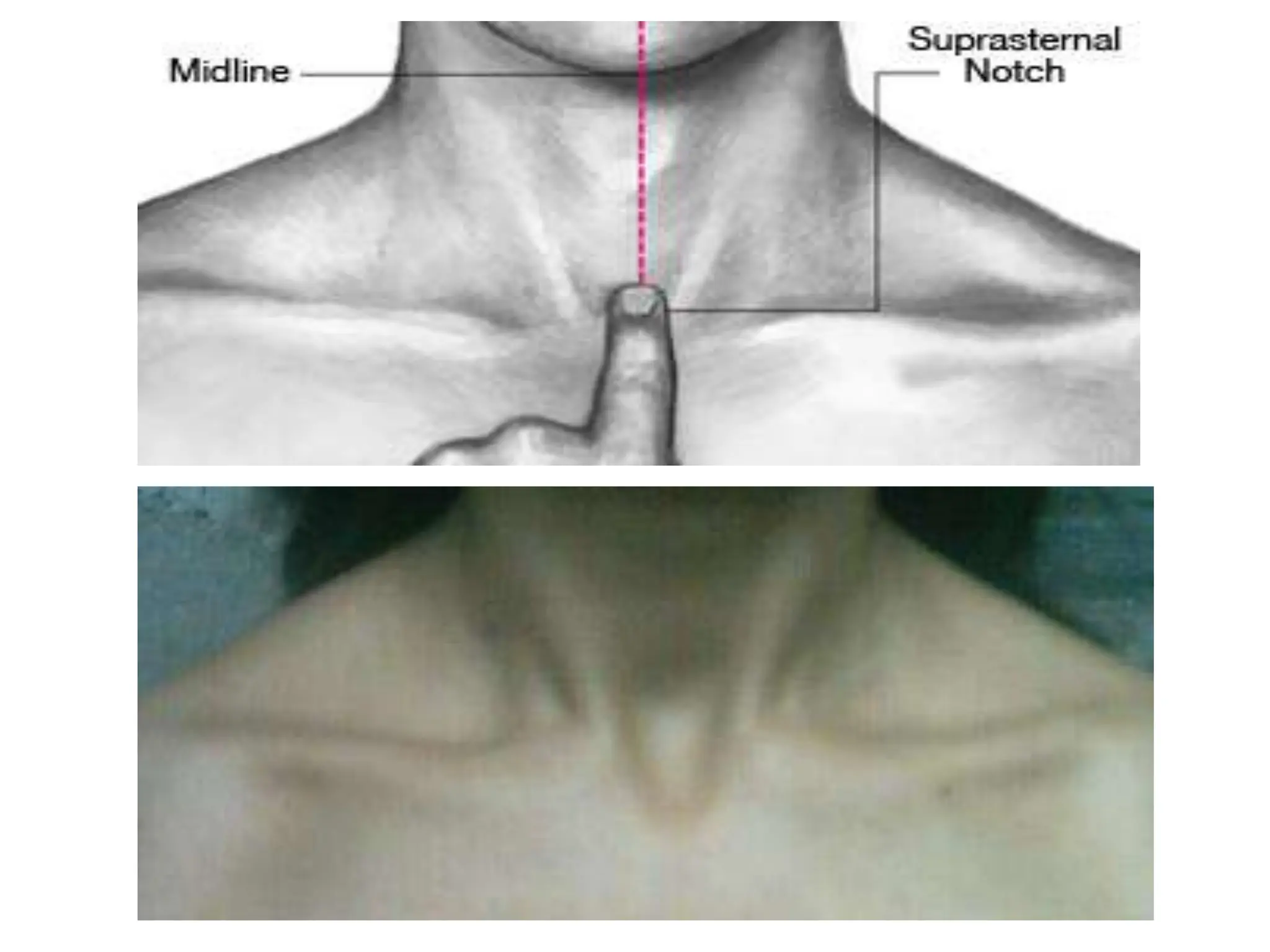 Chest Surface Anatomy-Lec 14.ppChest Surface Anatomy-Lec 14tx | PPT
