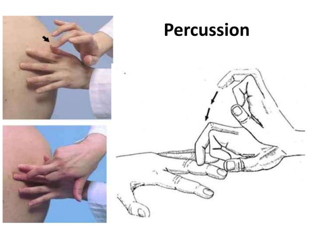 Chest Surface Anatomy-Lec 14.ppChest Surface Anatomy-Lec 14tx | PPT