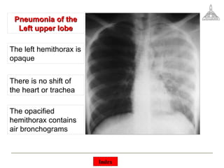 Chest surgical pathology &x rays | PPS