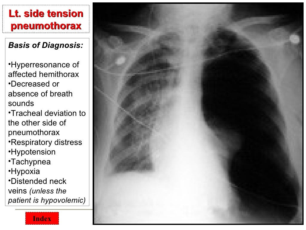 Chest surgical pathology &x rays
