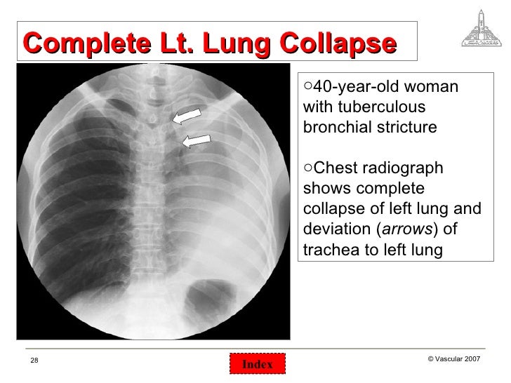 Chest surgical pathology &x rays