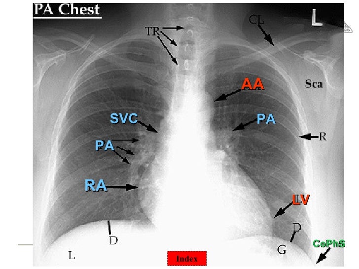 Chest surgical pathology &x rays